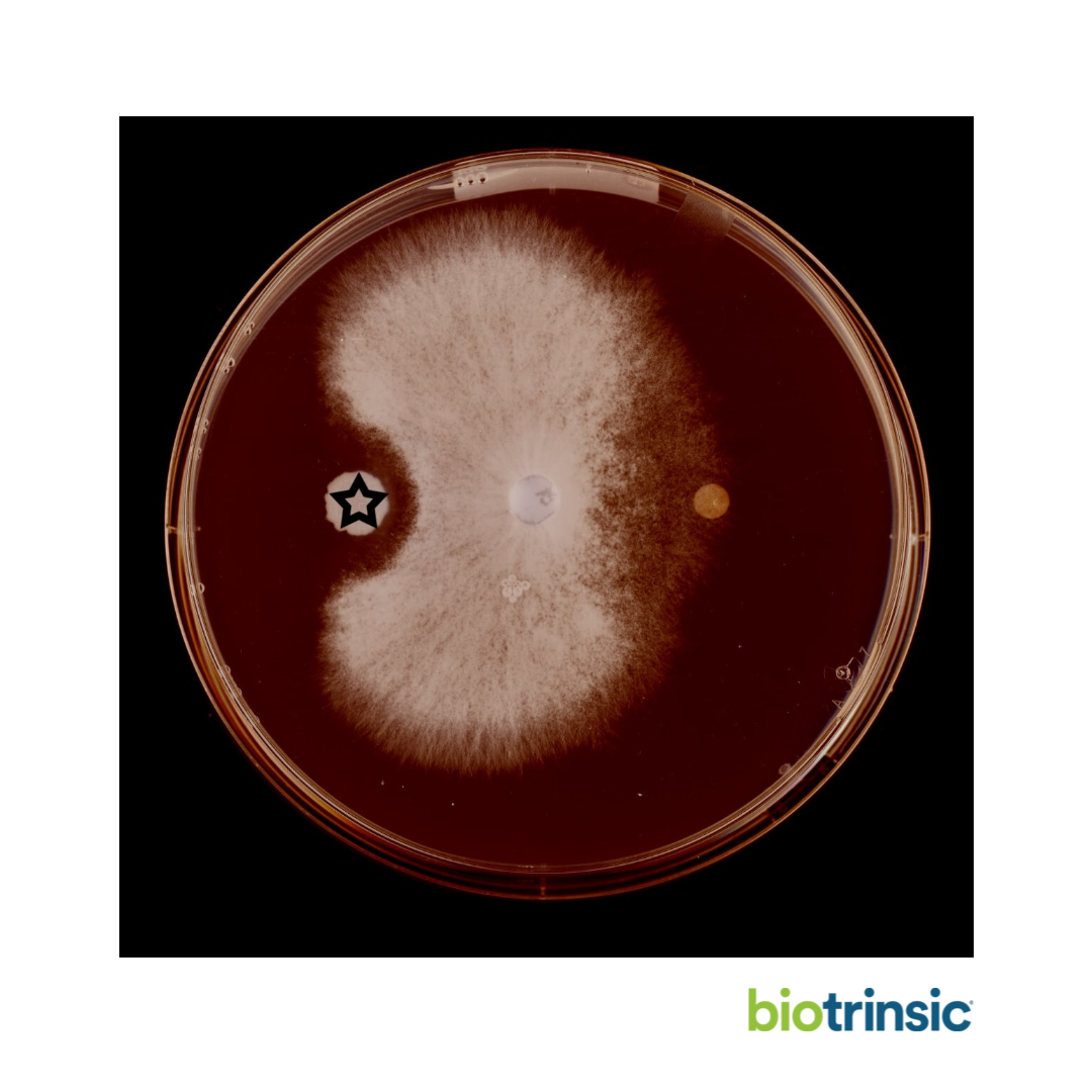 What's the Big Deal About Microbes?